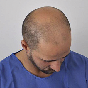 Caso de Éxito | Ricky Andrade - MediCapilar